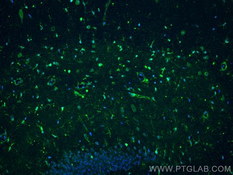 Glutamine Synthetase Antibody Cl488 66323 2 Proteintech