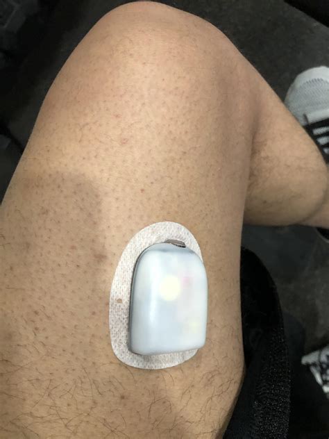 My Omnipod Suddenly Stopped While At The Gym 4pm Location Was Inner