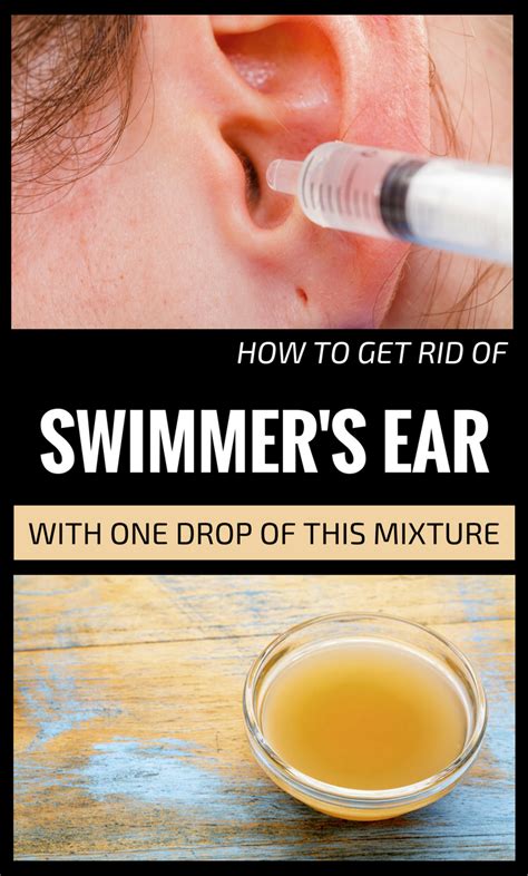 White Wine Vinegar For Swimmers Ear At Sergio Hasting Blog