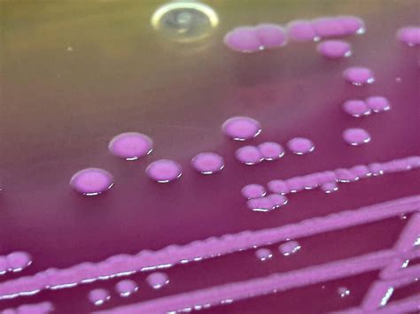 Microbe Notes Microbe Notes Added A New Photo