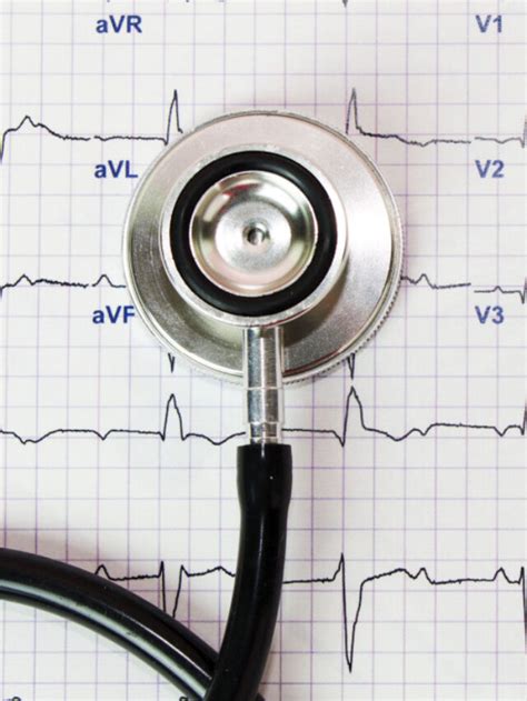 A Flutter Vs Afib What Are The Differences Between The Two