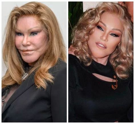 List 93 Pictures Jocelyn Wildenstein Before And After Pictures Updated