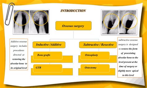 Resective Osseous Surgery Pptx