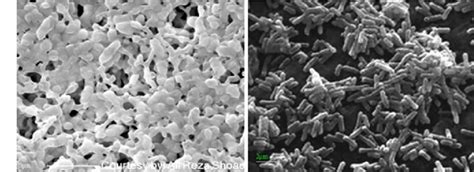 Electron Micrographs Of S Typhimurium After Recovery From 12 Vv