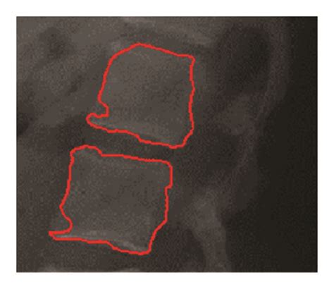 Segmentation Results Using The Proposed Method With Different Download Scientific Diagram