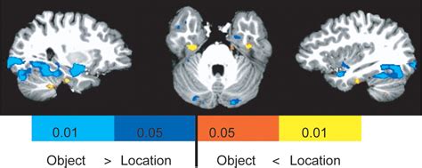 Distinct Roles For Medial Temporal Lobe Structures In Memory For