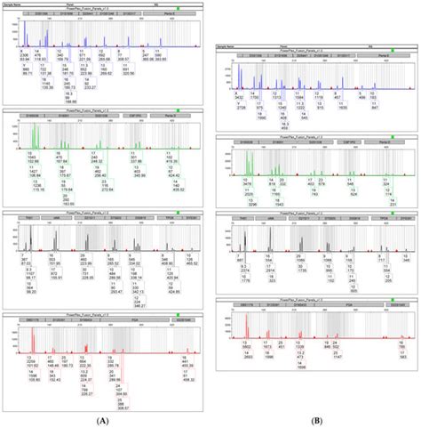 Application Of X Strs For Forensic Identification In Mixed Dna Profile A Case Report