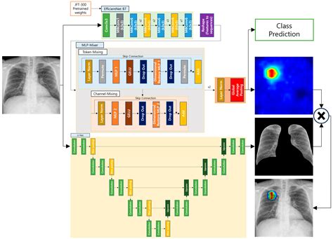 Active And Inactive Tuberculosis Classification Using Convolutional Neural Networks With Mlp Mixer
