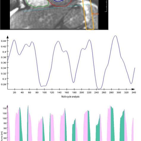 Top Placement Of Rectangular Mask To Detect Breathing Cycles Middle