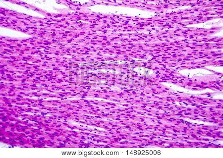 Heart Muscle Light Image Photo Free Trial Bigstock