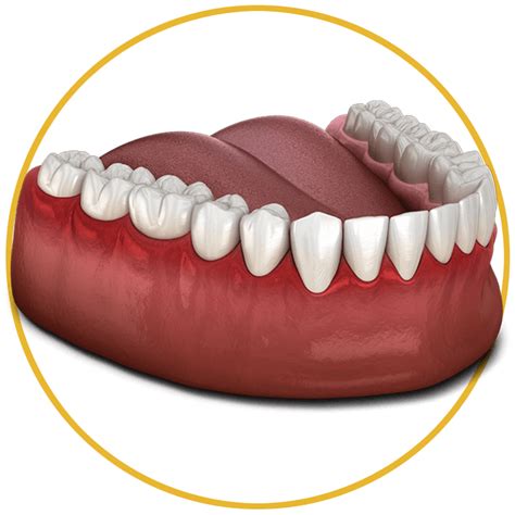 Gum Disease Treatment Greater San Antonio Elite Dental And Implant Center