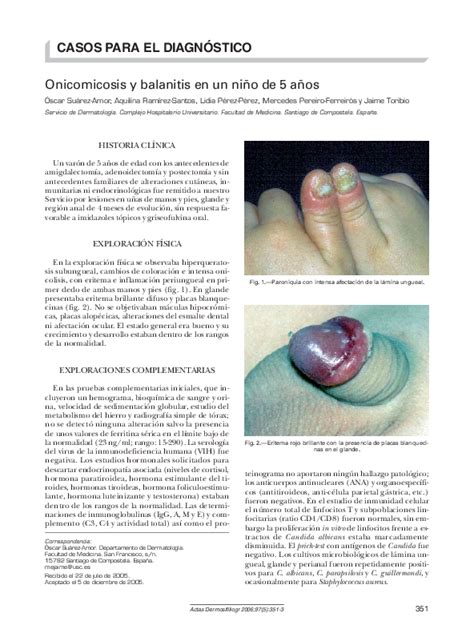 Pdf Onicomicosis Y Balanitis En Un Niño De 5 Años