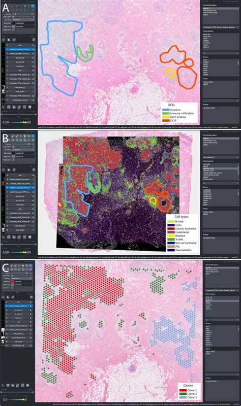 Spatialdata An Open And Universal Data Framework For Spatial Omics Pmc