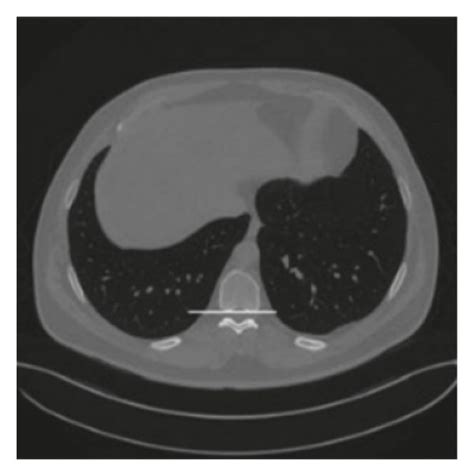 Intensity Profile From The Selected Denoising Algorithms A Reference