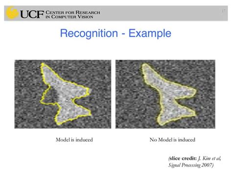 Lec7 Medical Image Segmentation I Radiology Applications Of Segmentation And Thresholding
