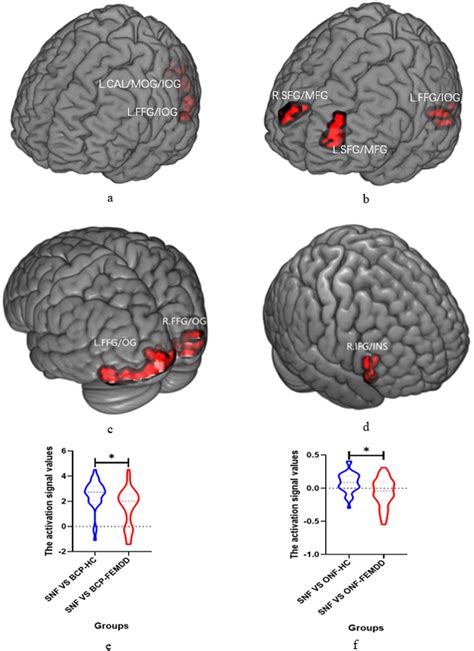 Figure 1 From Hypoactive Visual Cortex Prefrontal Cortex And Insula During Self Face