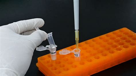 Video Diatom Dna Extraction From Water Sample And Human Lung Tissue