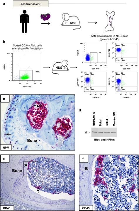 A Xenograft Model Of Human Npm1 Mutated Aml Cd34 Cells From Download Scientific Diagram