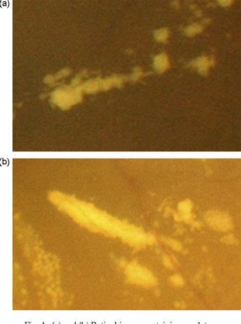 Figure 1 From Automatic Detection Of Diabetic Retinopathy Exudates From Non Dilated Retinal