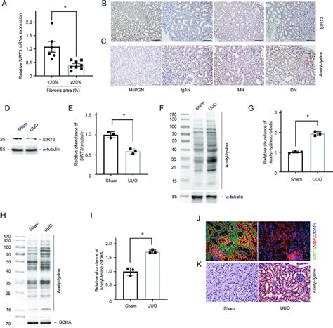 Sirt3 Regulates Acetylation Of Tubular Mitochondrial Proteins In Renal Download Scientific