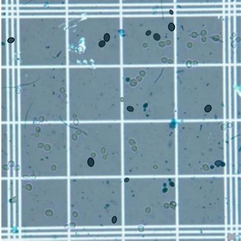 how to use the yeast cell infection instance segmentation api