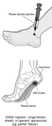 20550 Cpt Code Cpt Codes Medical Coding Medical Billing And Coding