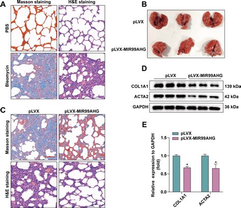 Mir99ahg Inhibited Lung Fibers In Rats A Masson Staining And Hande