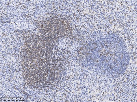 Anti Cd3 Epsiloncd3e Antibody Mouse Mab 90047 Mm11 Sino Biological