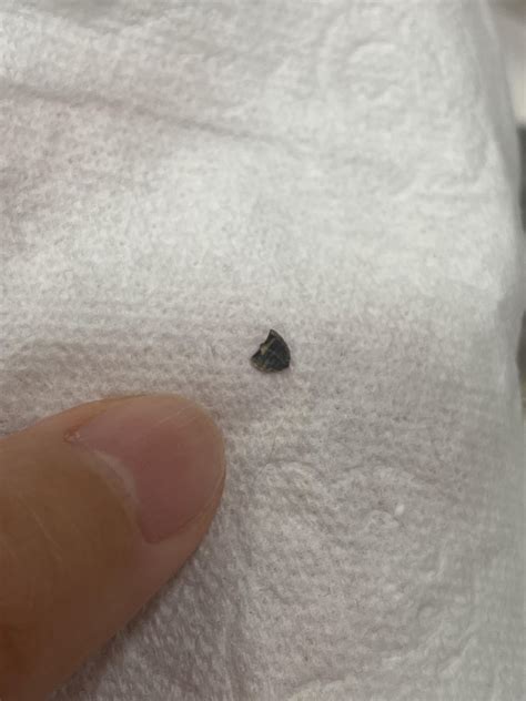 Id Bug Shell Rbedbugs Id Bug Shell Rbedbugs