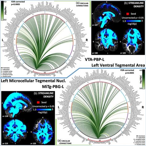 a region‐based 2d structural connectome and b voxel‐based