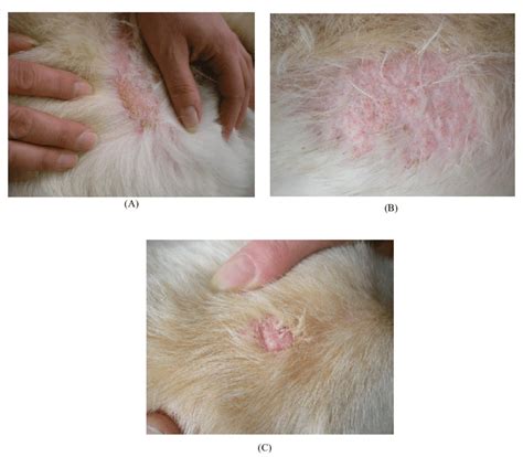 A Diffuse Impetigo Like Dermatitis At Hair Loss Area B Download Scientific Diagram