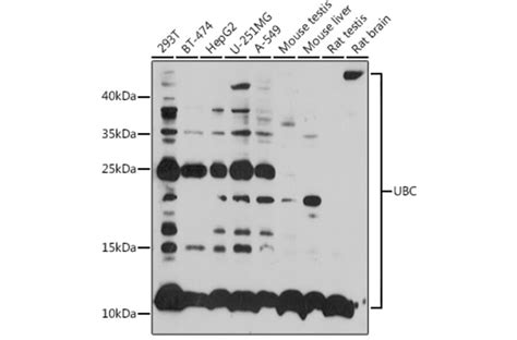 Anti Ubiquitin Antibody A14408