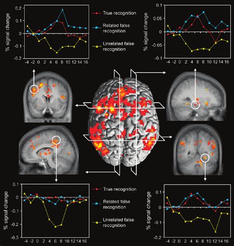 Neural Activity Associated With Both True Recognition Labeling A Same Download Scientific