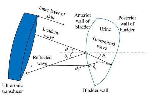 Sensors Free Full Text A Mode Ultrasound Bladder Volume Estimation