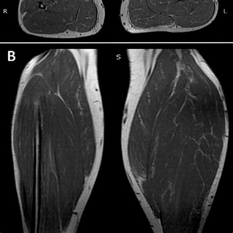 Causes Of Unilateral Lower Extremity Edema Based On 2 Modified Download Scientific Diagram