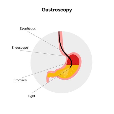 Premium Vector Gastroenterology Concept Gastroscopy