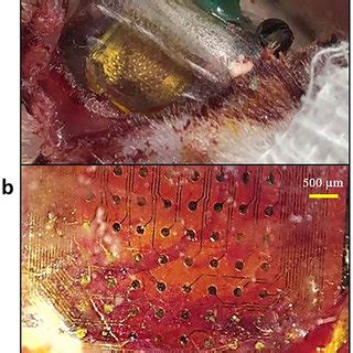 a In house fabricated μEcoG array with reference contact b Robust Download Scientific