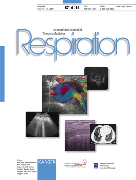 Pneumothorax Following Endobronchial Valve Therapy And Its Impact On Clinical Outcomes In Severe