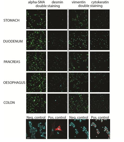 Figure 1 From Different Roles Of Calcium Signaling In The Gastrointestinal Tract Semantic Scholar