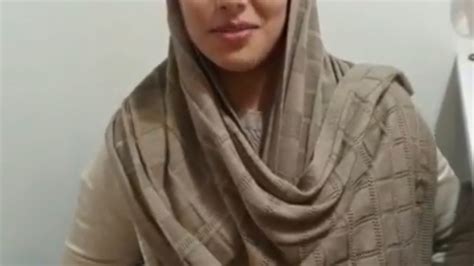 انجام 16 واحد ونیر کامپوزیت برای زیبا جوی عزیز توسط دکتر سحر میرآبا نماشا