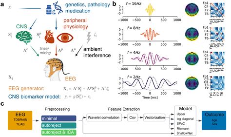 Machine Learning Of Brain Specific Biomarkers From Eeg Ebiomedicine