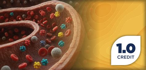 Updated Imwg Guidelines Spotlight Mrd Functional Imaging And Light