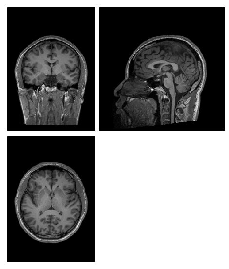 Preprocessing Anomaly From Fmriprep Software Support Neurostars