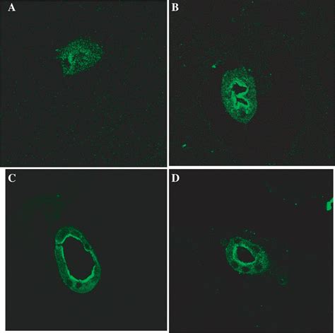 Phosphatonin Washout In Hyp Mice Proximal Tubules Evidence For
