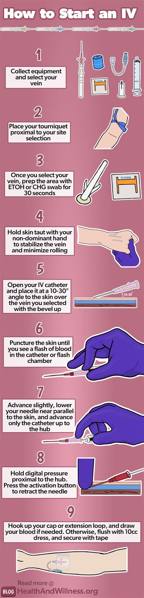 How To Start An Iv Health And Willness