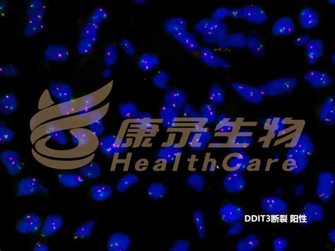 Ddit3（12q13）基因重排探针试剂（原位杂交法） 武汉康录生物技术股份有限公司