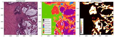 Github Chenpan311 Colorectal Histology Classification