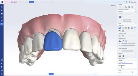 new software releases planmeca romexis