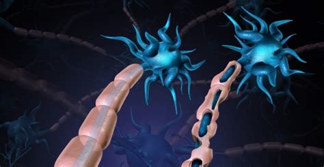 Causes And Effects Of Demyelination Facty Health
