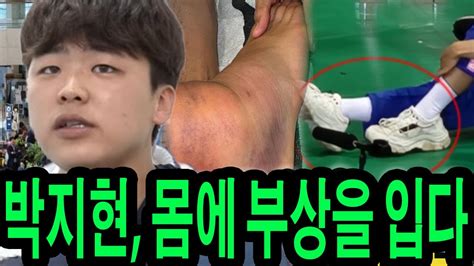 충격 박지현 몸에 상처 하나 입고 팬들 걱정시키는 중 왜 박지현의 건강이 나빠졌나요 매니저 박지현의 현재 상태가 위급하다 무슨 일 Youtube